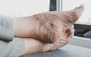 Aging Feet Changes and Common Problems - Massage and Spa Blog
